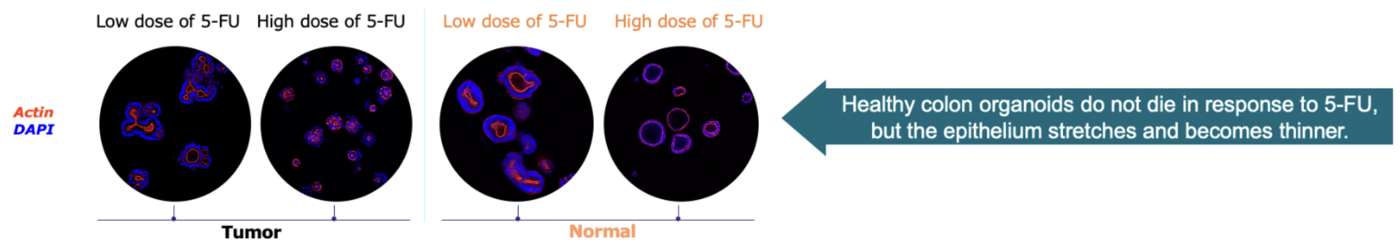 Pairing 3D Organoids with High-Content Imaging Can Develop Clear Views ...