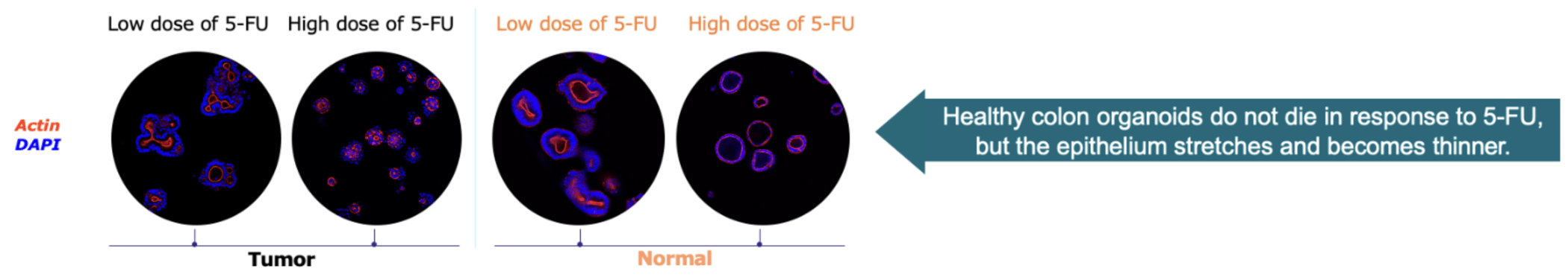 Pairing 3D Organoids with High-Content Imaging Can Develop Clear Views ...