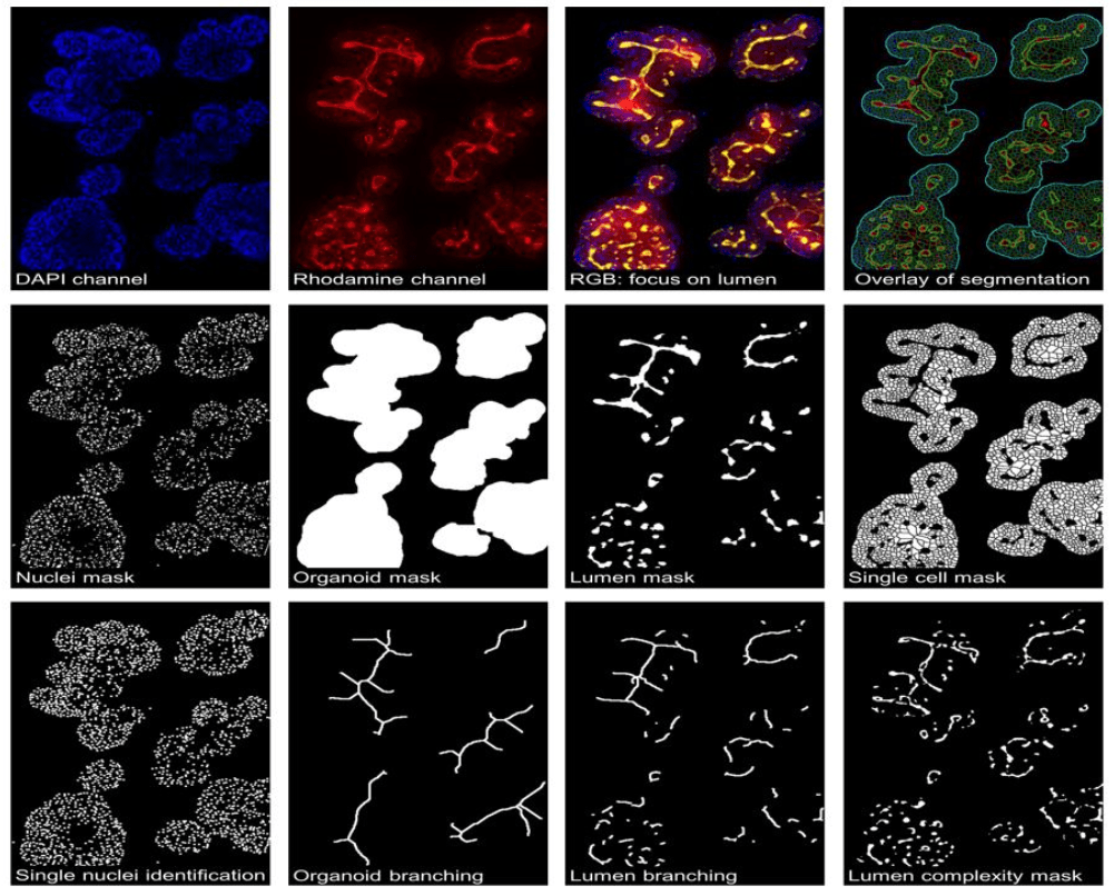 High Content What? Deciphering between High-Content Imaging (HCI), High ...