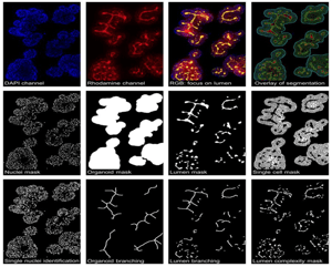 High Content What? Deciphering between High-Content Imaging (HCI), High ...