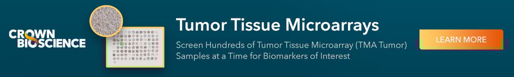 Tumor Microarray 101