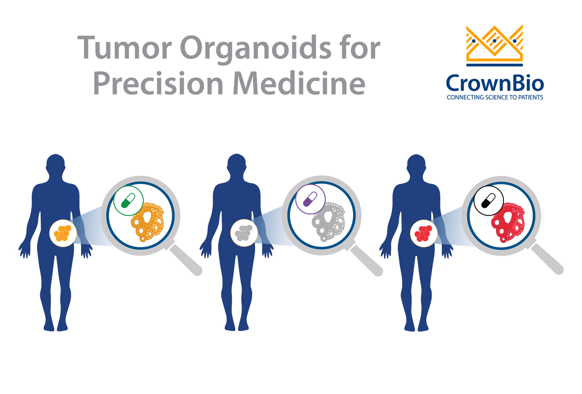 The Role of Patient-Derived Tumor Organoids in Precision Medicine