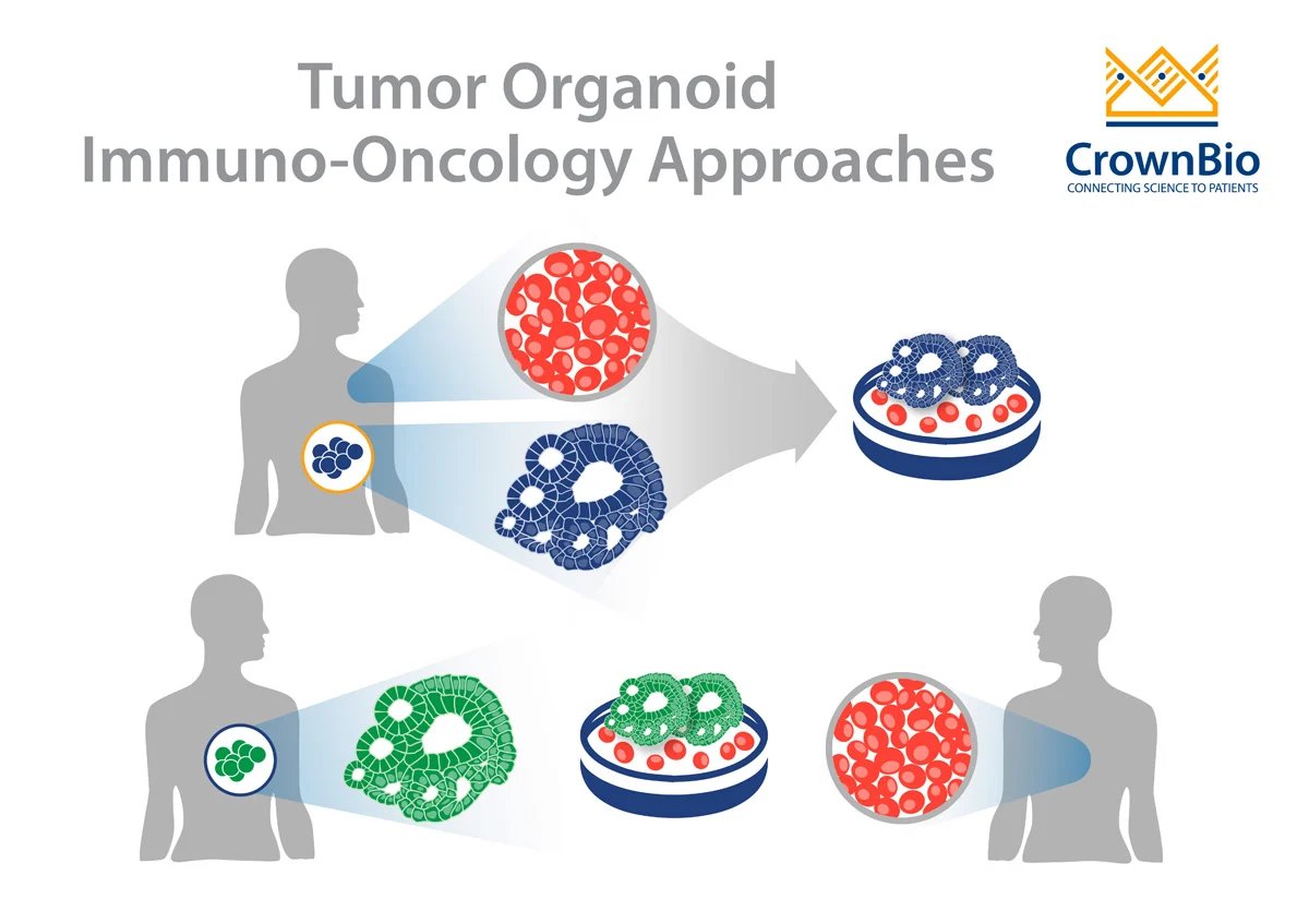 How to Use Tumor Organoids for Immuno-Oncology Applications
