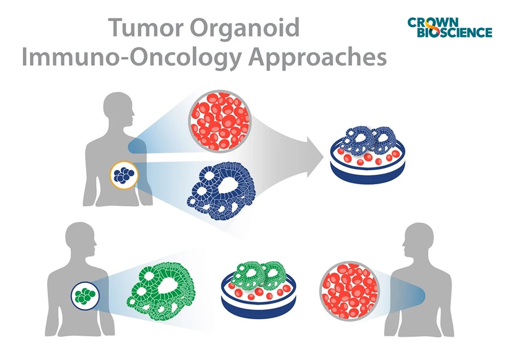 How To Use Tumor Organoids For Immuno Oncology Applications